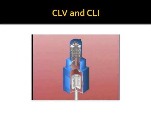 Countergravity low pressure air (cla) | PPTX