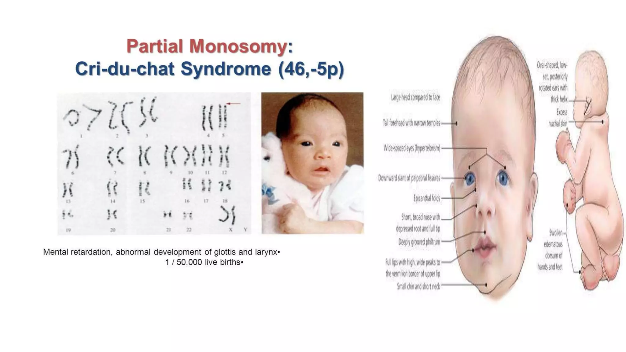 Coupling and repulsion human genetics | PPTX