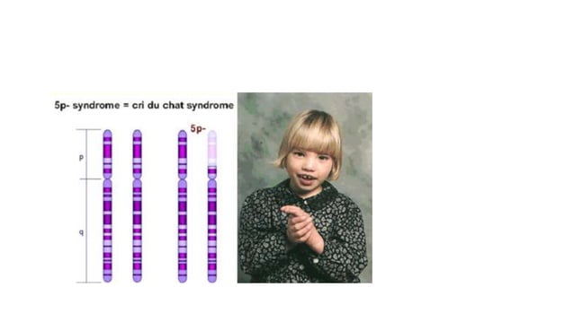 Coupling and repulsion human genetics | PPTX
