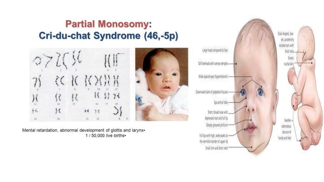 Coupling and repulsion human genetics | PPTX
