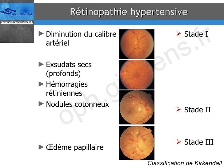 Cours aux externes "Retine medicale"