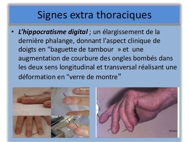 Cours de sémiologie