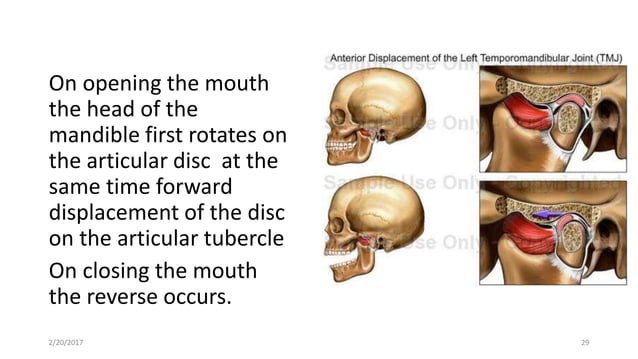 Course 2016 MANDIBLE MUSCLES OF MASTICATION AND TEMPOROMANDIBULAR JOINT ...