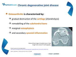 Course of osteoarthritis | PPT