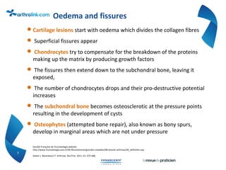 Course of osteoarthritis | PPT | Bone and Joint Conditions | Diseases ...