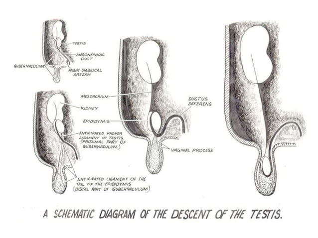 Scrotal Ultrasound Ppt