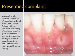 Coverage of Gingival Recession and Mucosal Fenestration copy.ppt
