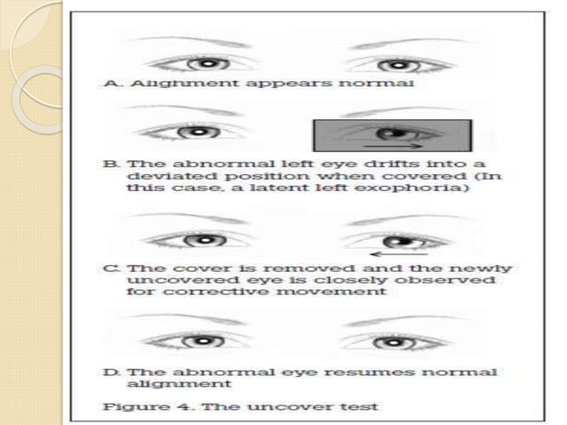 Cover tests | PPTX | Eye and Vision Conditions | Diseases and Conditions
