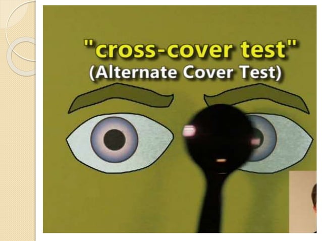 Cover tests | PPTX | Eye and Vision Conditions | Diseases and Conditions