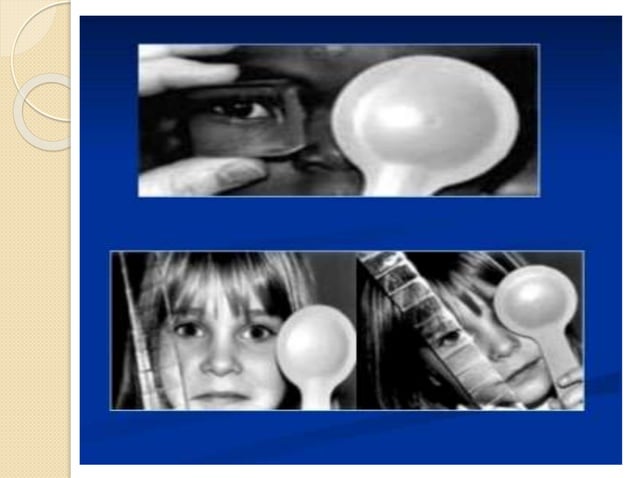 Cover tests | PPTX | Eye and Vision Conditions | Diseases and Conditions