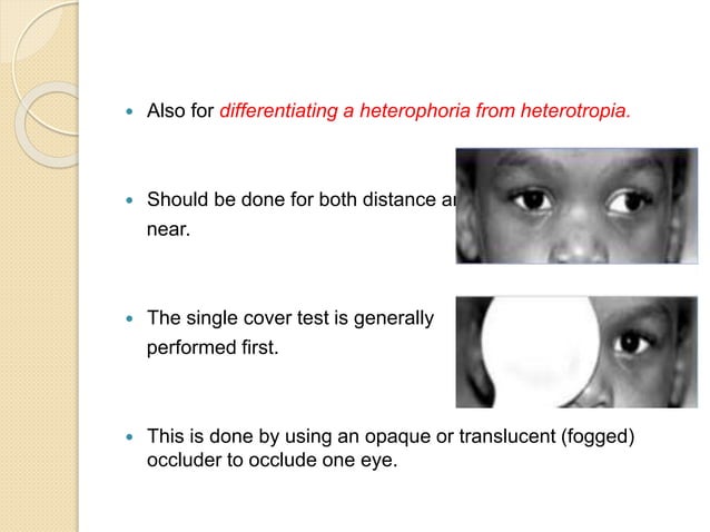 Cover tests | PPTX | Eye and Vision Conditions | Diseases and Conditions