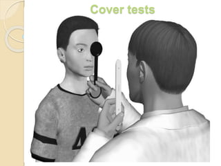 Cover Uncover Test