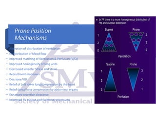 COVID19 and Patient mechanical Ventilation | PDF