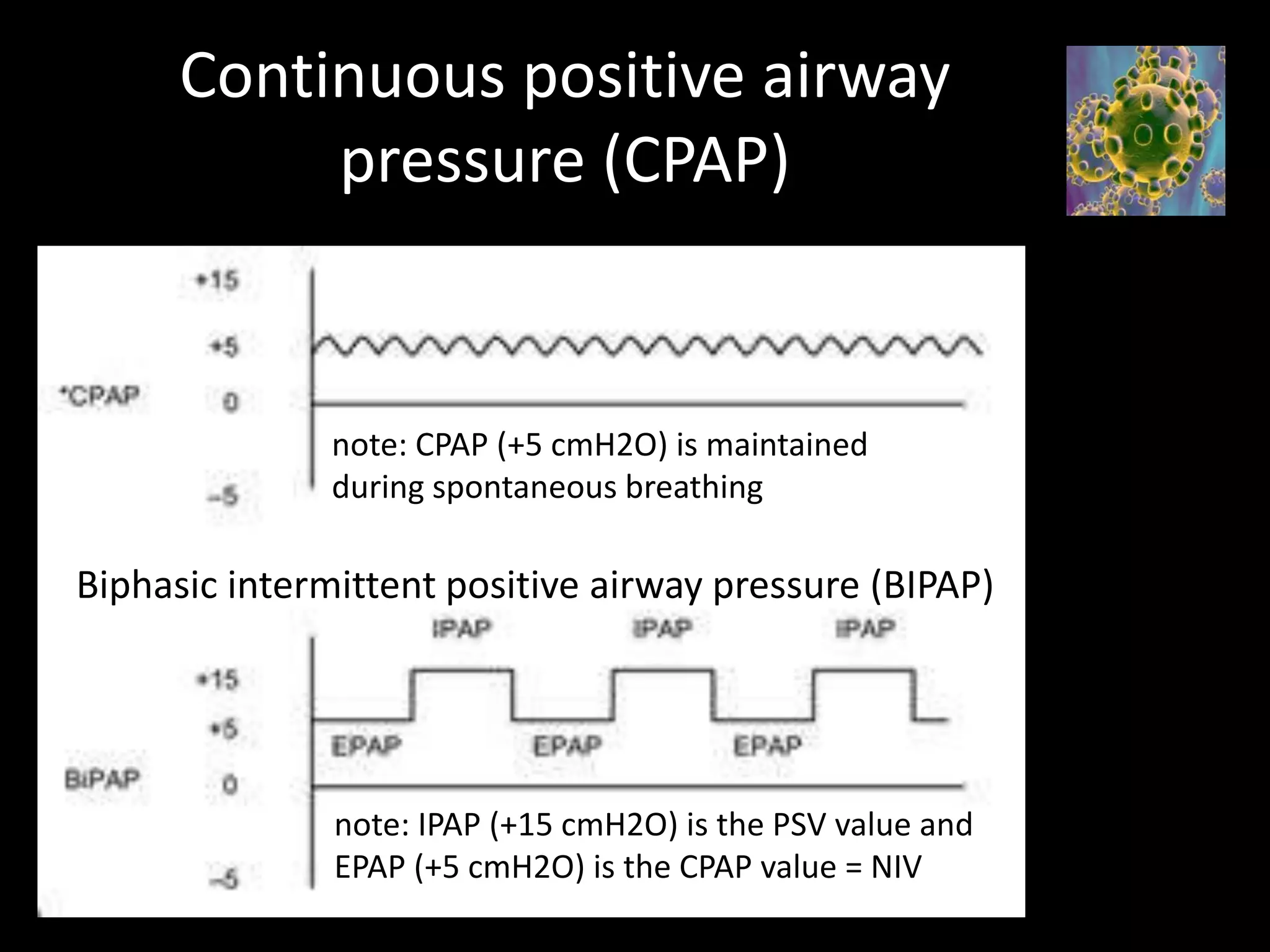 COVID-19 Critical Care + ventilation.pptx