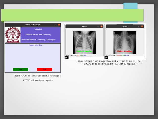 COVID-19 detection using Chest X-rays.pdf