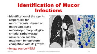 Mucor Microscopic Identification