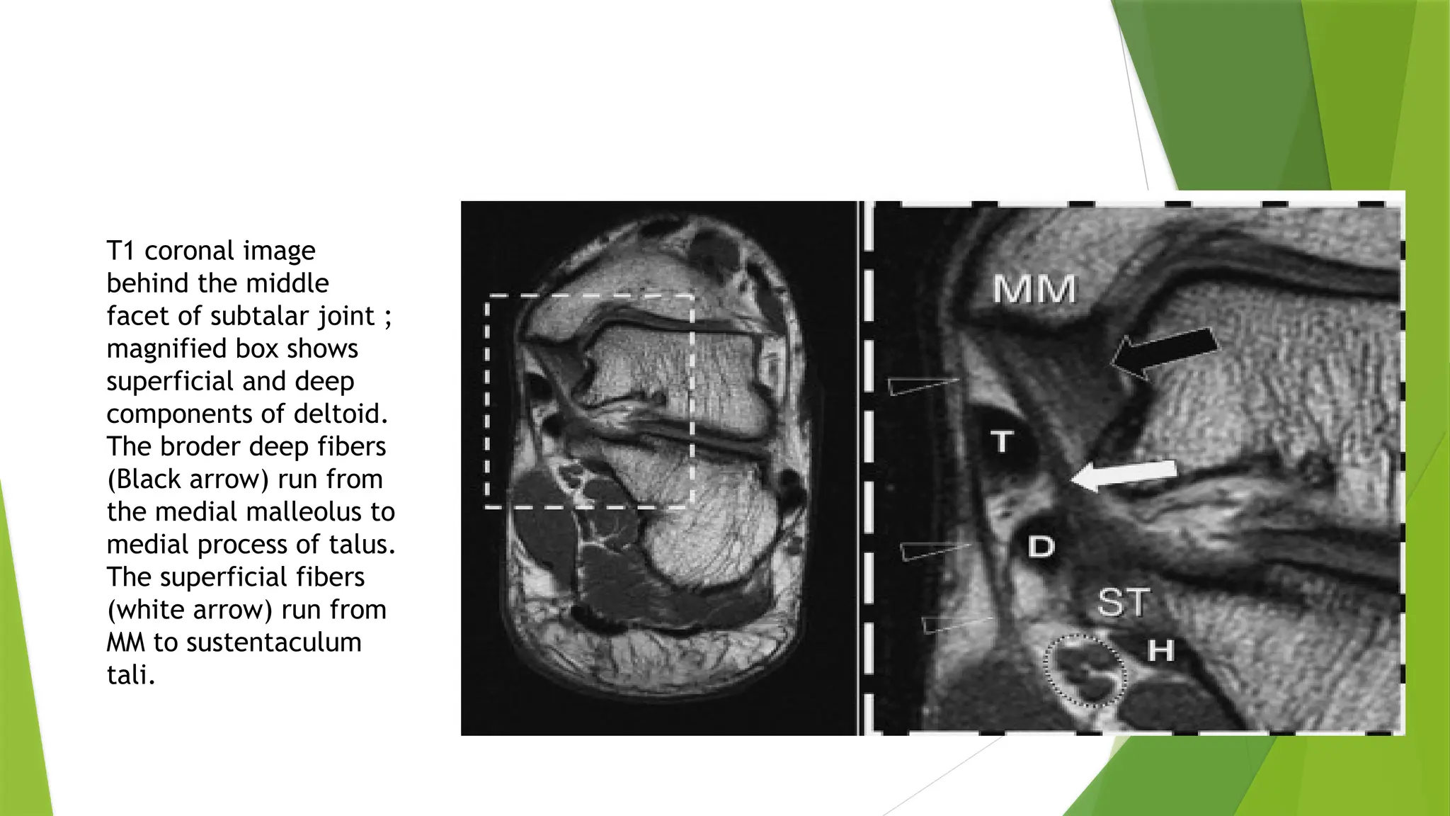 COW_ankle anatomy radiology with xrays and MRI | PPTX