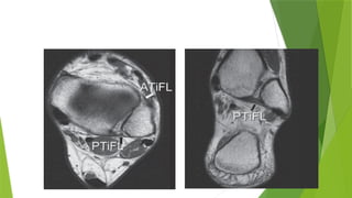 COW_ankle anatomy radiology with xrays and MRI | PPTX