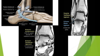 COW_ankle anatomy radiology with xrays and MRI | PPTX
