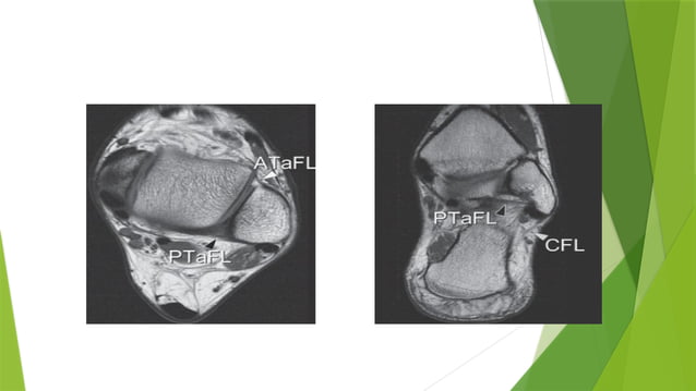 COW_ankle anatomy radiology with xrays and MRI | PPT