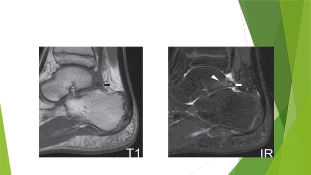 COW_ankle anatomy radiology with xrays and MRI | PPT