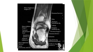 COW_ankle anatomy radiology with xrays and MRI | PPTX