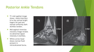COW_ankle anatomy radiology with xrays and MRI | PPTX