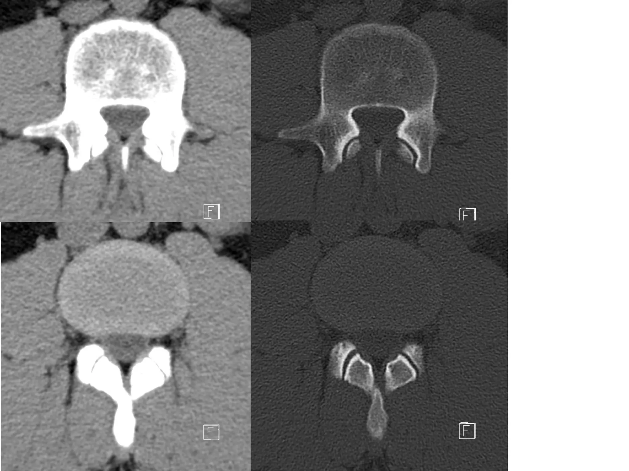 Imaging for back pain | PPT