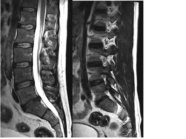 Imaging for back pain | PPT