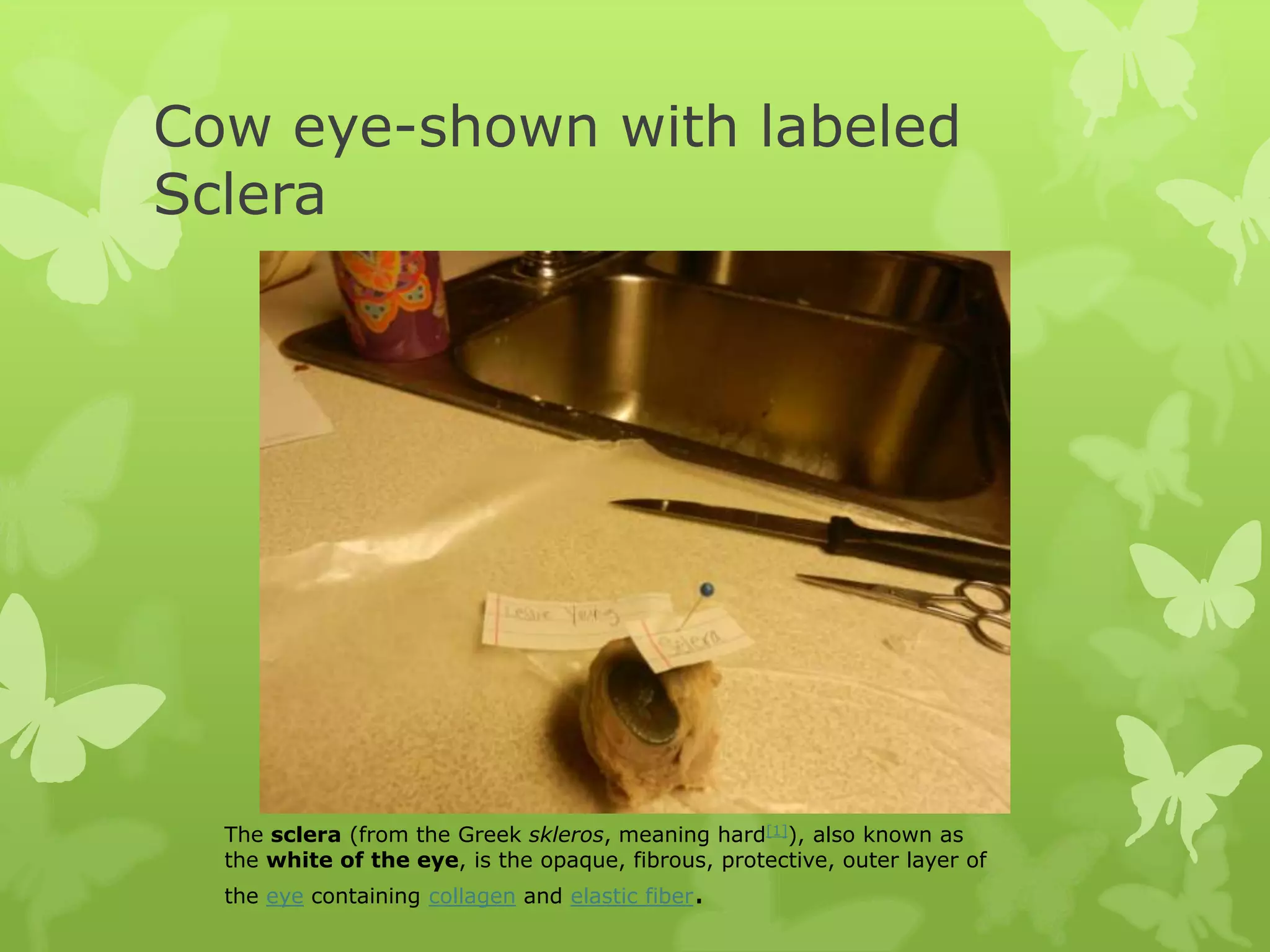 Cow eye – dissection and label | PPTX