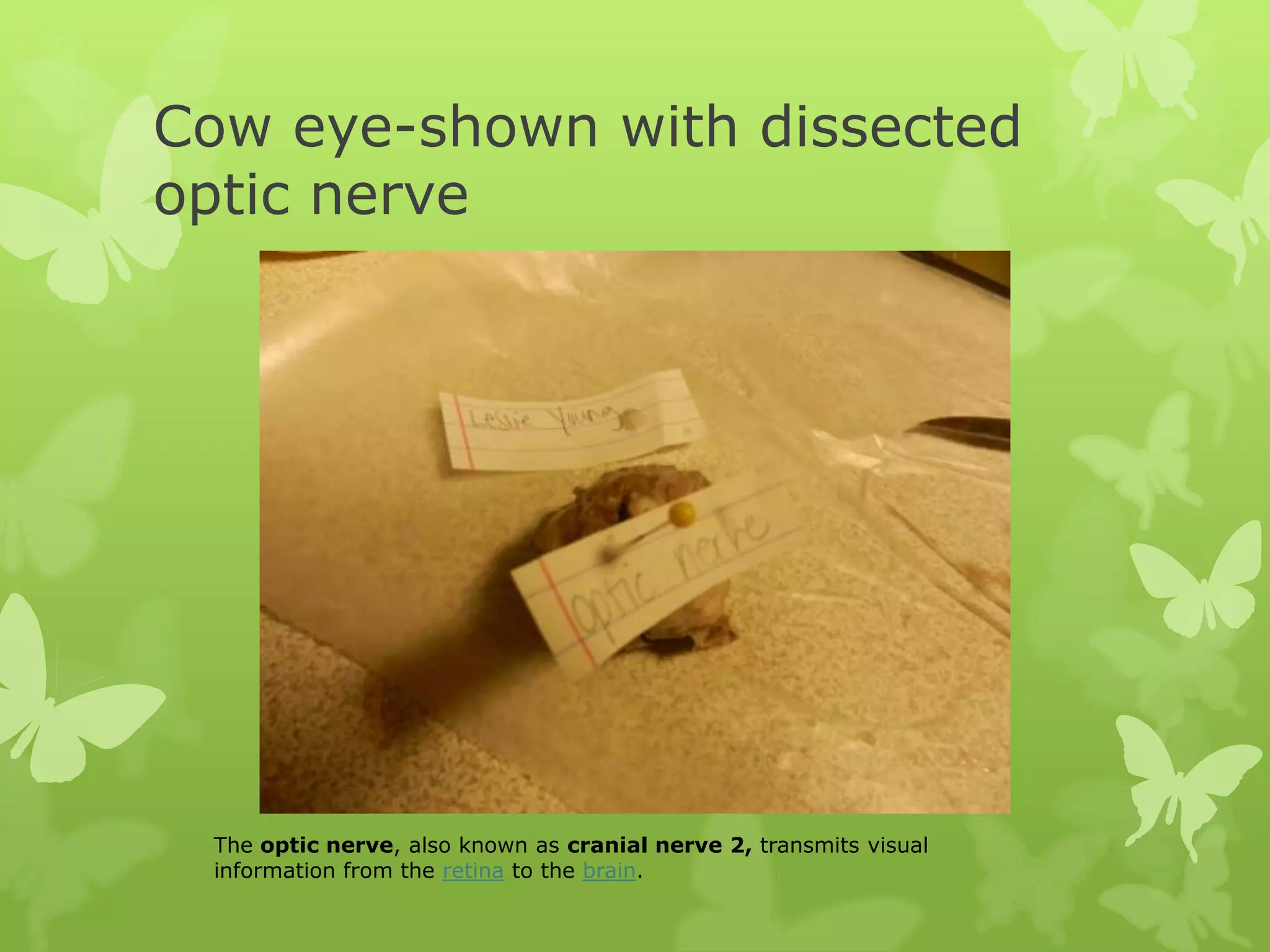 Cow eye – dissection and label | PPTX