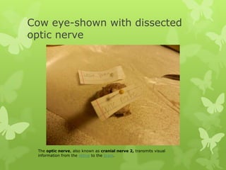 Cow eye – dissection and label | PPTX