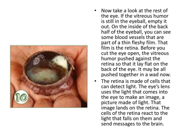 Cow's Eye Dissection Instructions | PPTX | Eye and Vision Conditions ...