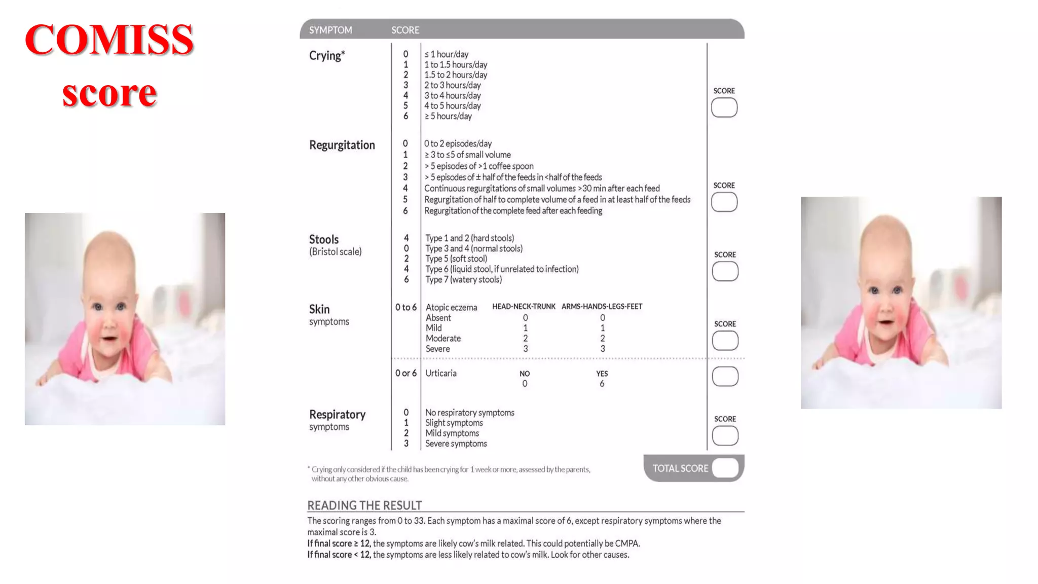 Cow's milk protein allergy | PPTX