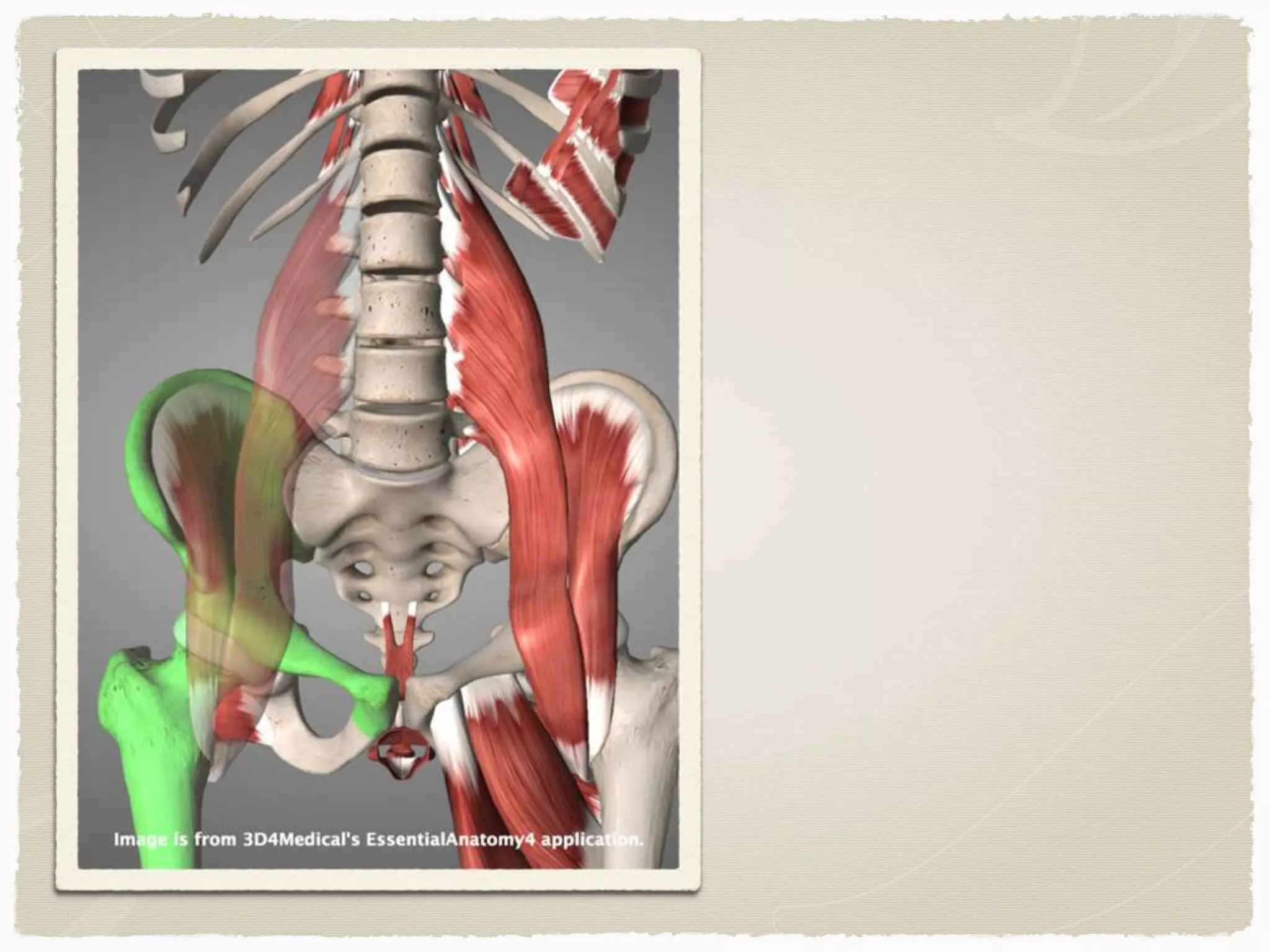 Coxa sultans - External Snapping Hip | PPTX