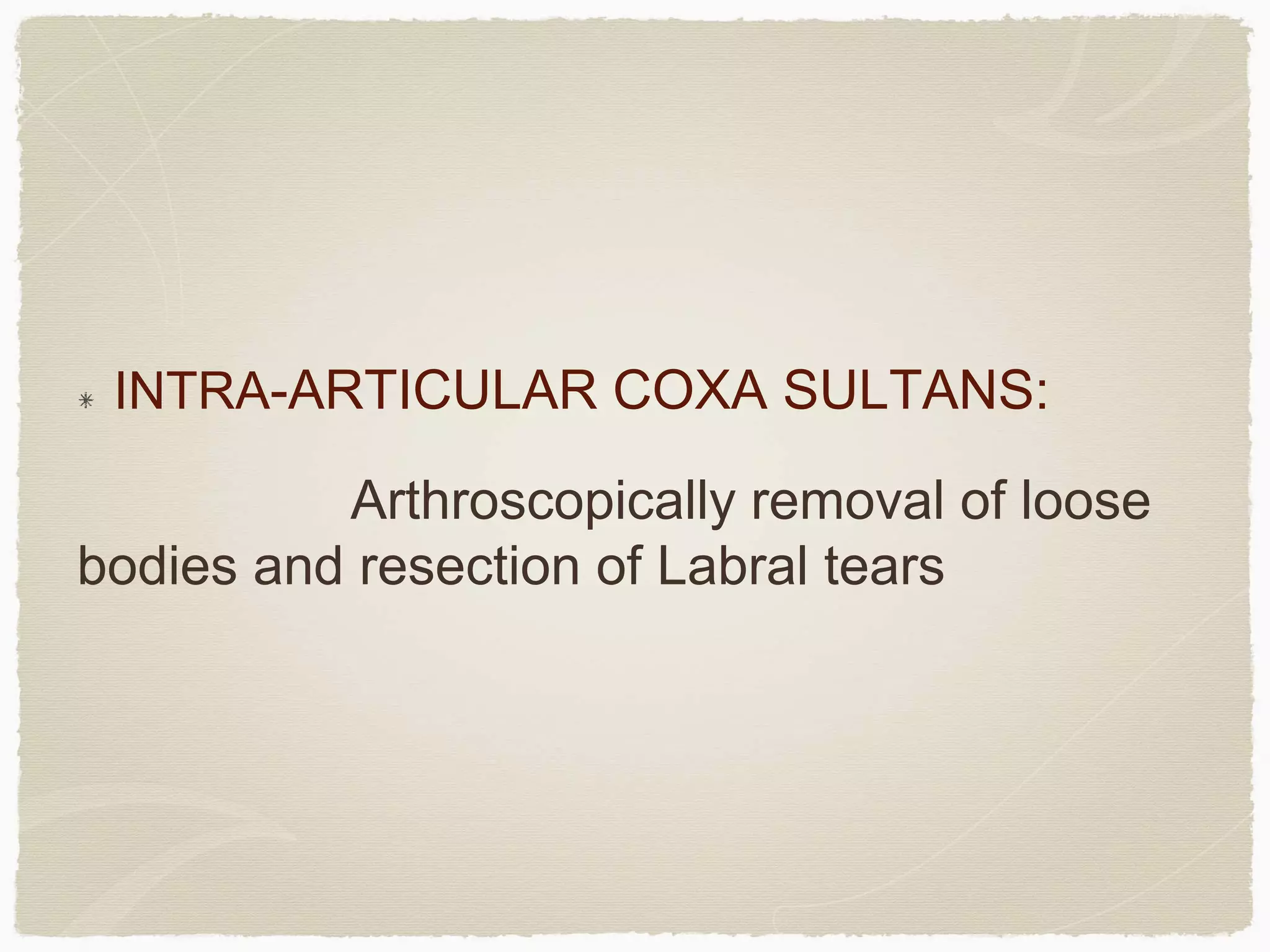 Coxa sultans - External Snapping Hip | PPTX
