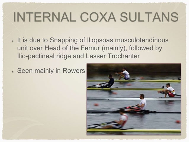 Coxa sultans - External Snapping Hip | PPTX