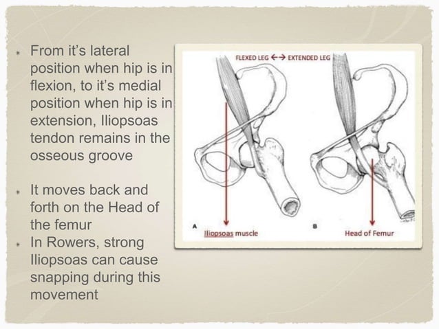 Coxa sultans - External Snapping Hip | PPTX