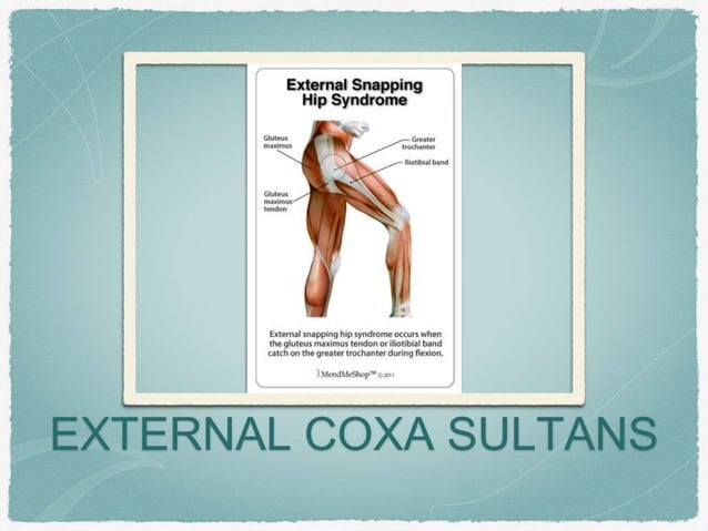 Coxa sultans - External Snapping Hip | PPTX