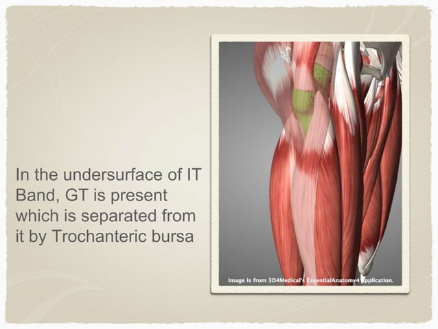 Coxa sultans - External Snapping Hip | PPTX