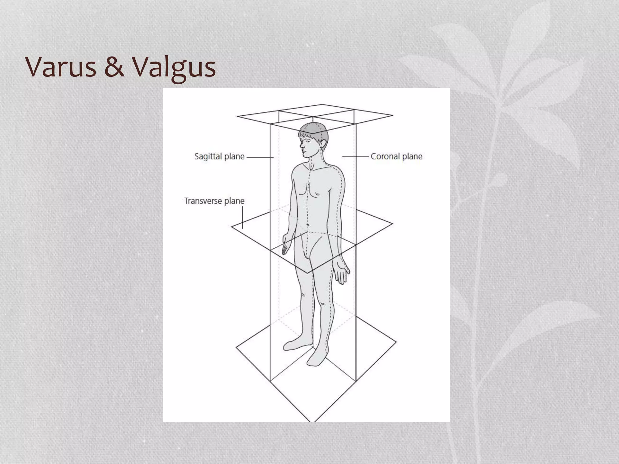Coxa Vara, Genu VArum & Valgum. Under Gradts. | PPTX
