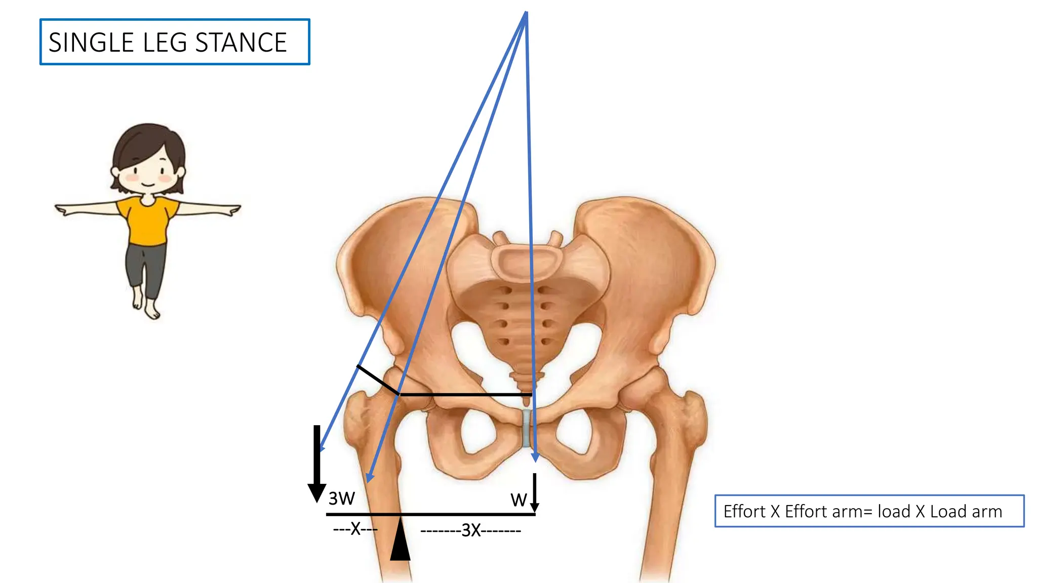 COXA VARA AND COXA VALGA, DEVLOPMENTAL COXA VARA.pptx