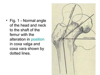 Coxavaradnbid 110424114226-phpapp02 | PPT