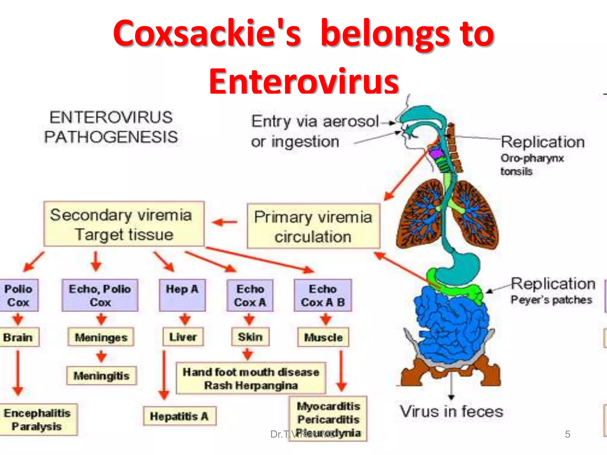 Coxsackievirus (2).ppt