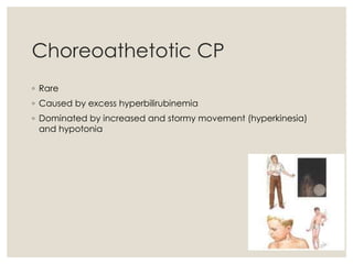 CEREBRAL PALSY | PPTX