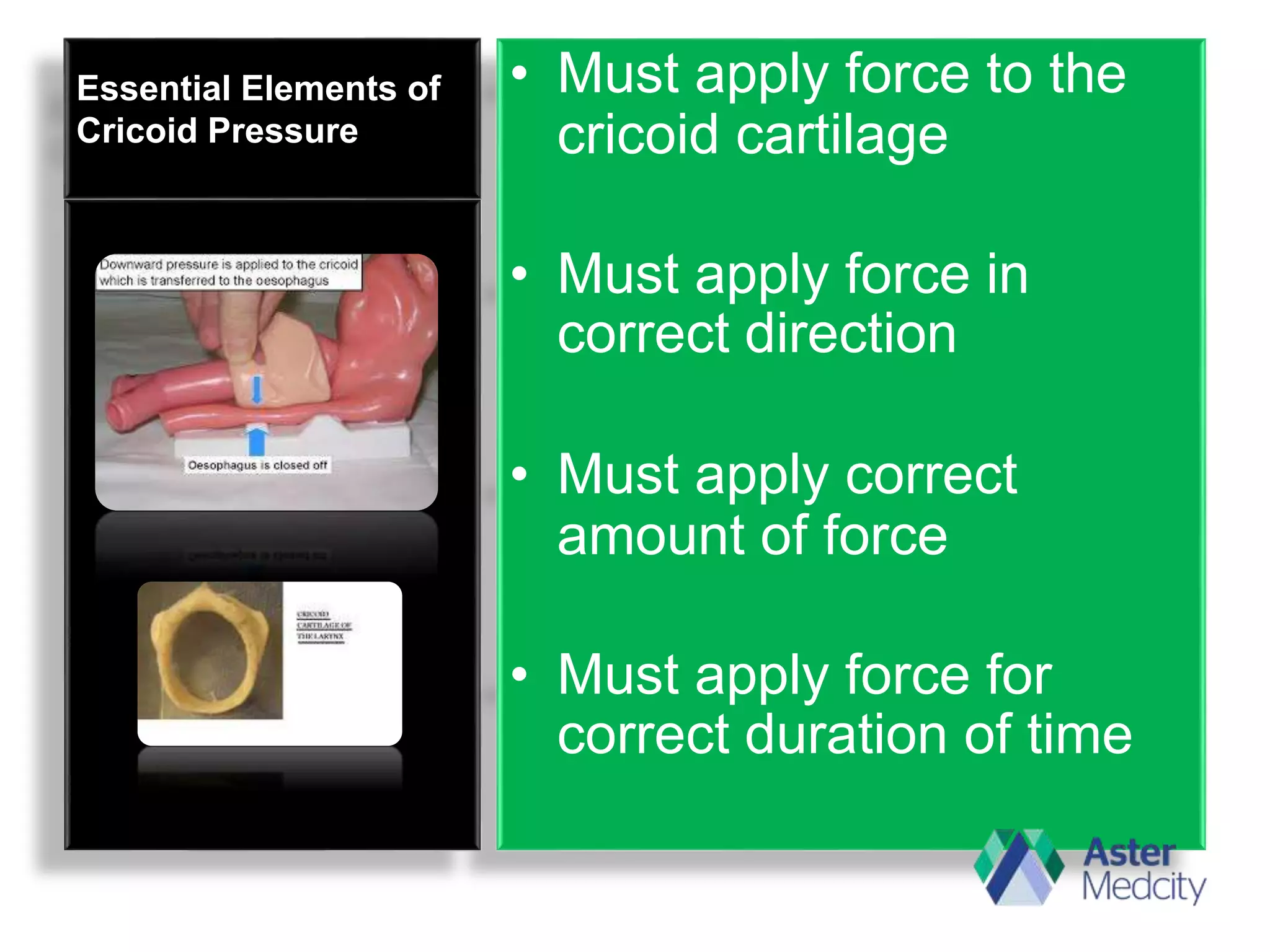 Cricoid pressure -Yes or No? | PPTX