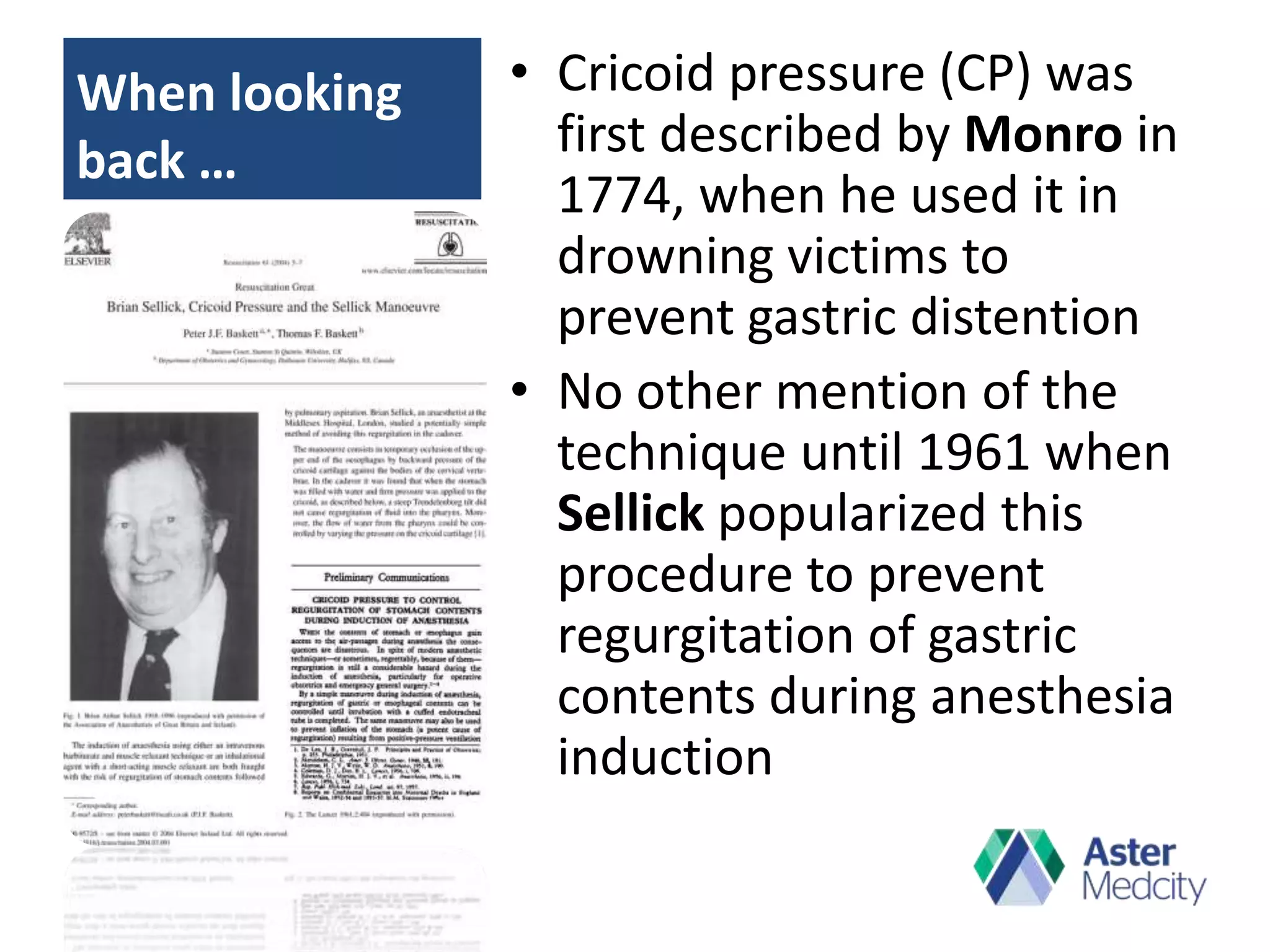 Cricoid pressure -Yes or No? | PPTX