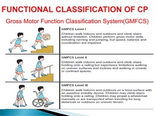 CEREBRAL PALSY | PDF
