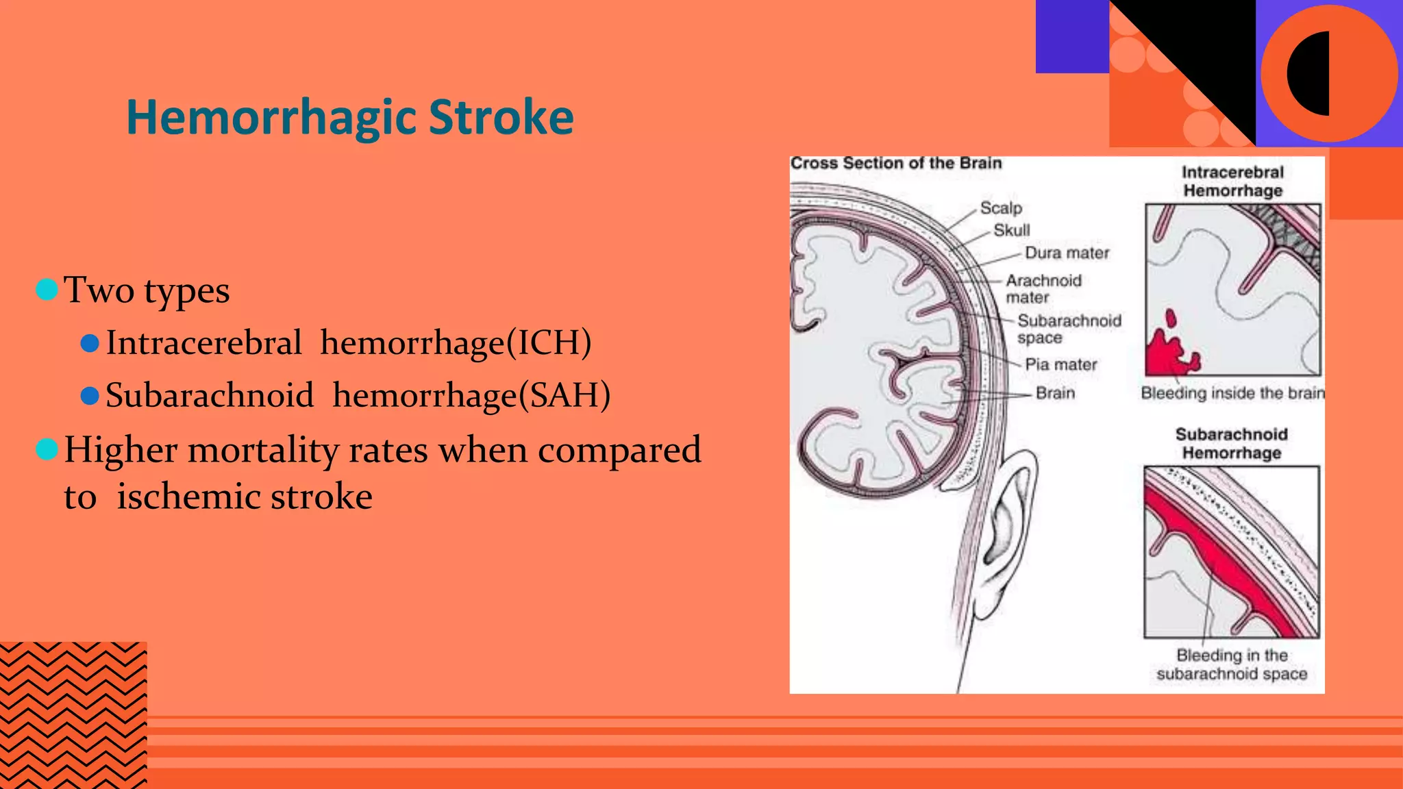CP - Hemorrhagic stroke.pptx