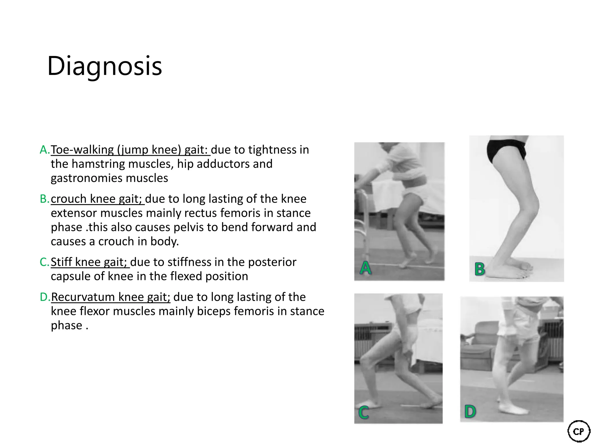 Cerebral palsy in orthopaedics..2..pptx
